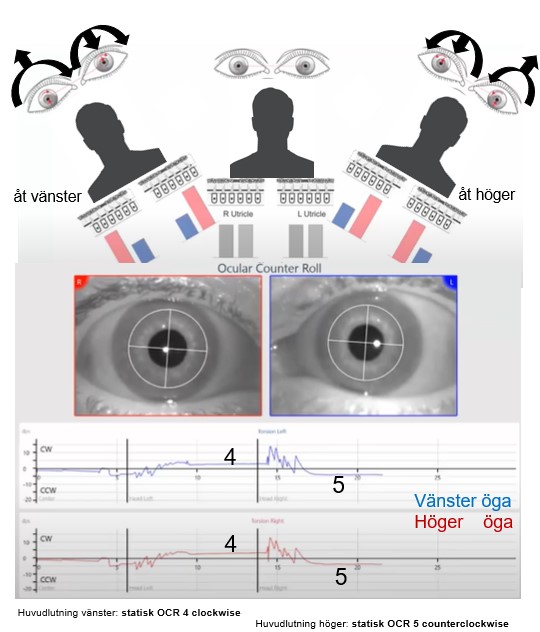 Hinnsäckstest OCR - Balanslaboratoriet